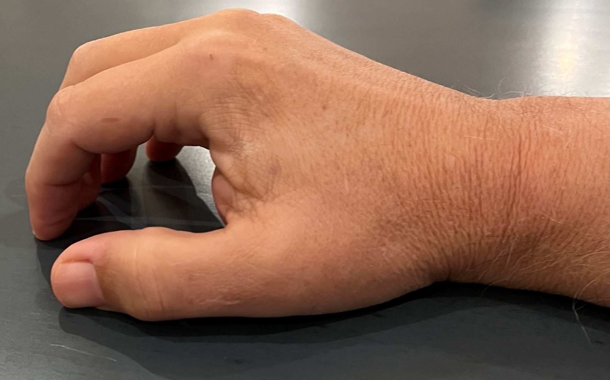 Exercises to Strengthen the Fourth and Fifth Fingers